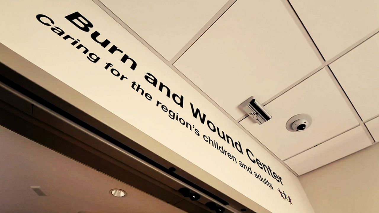 UW Health burn center prepares to open