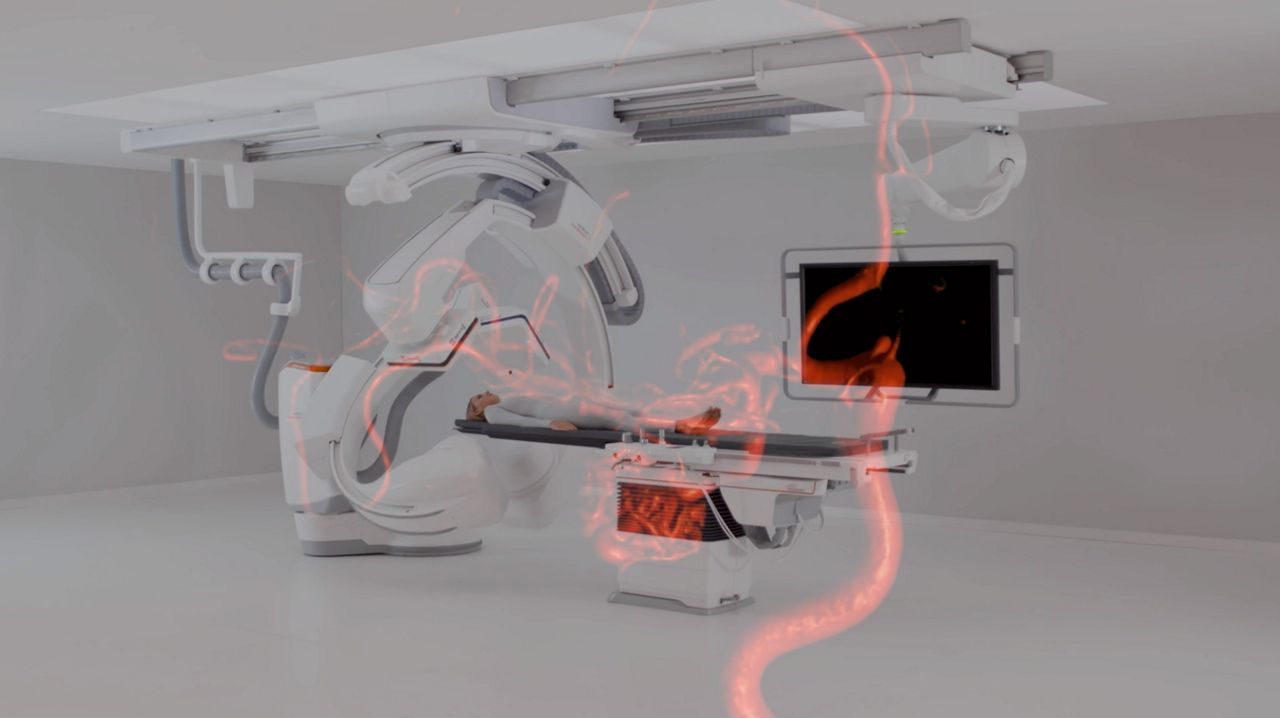 New surgical imaging device first in nation used at UW