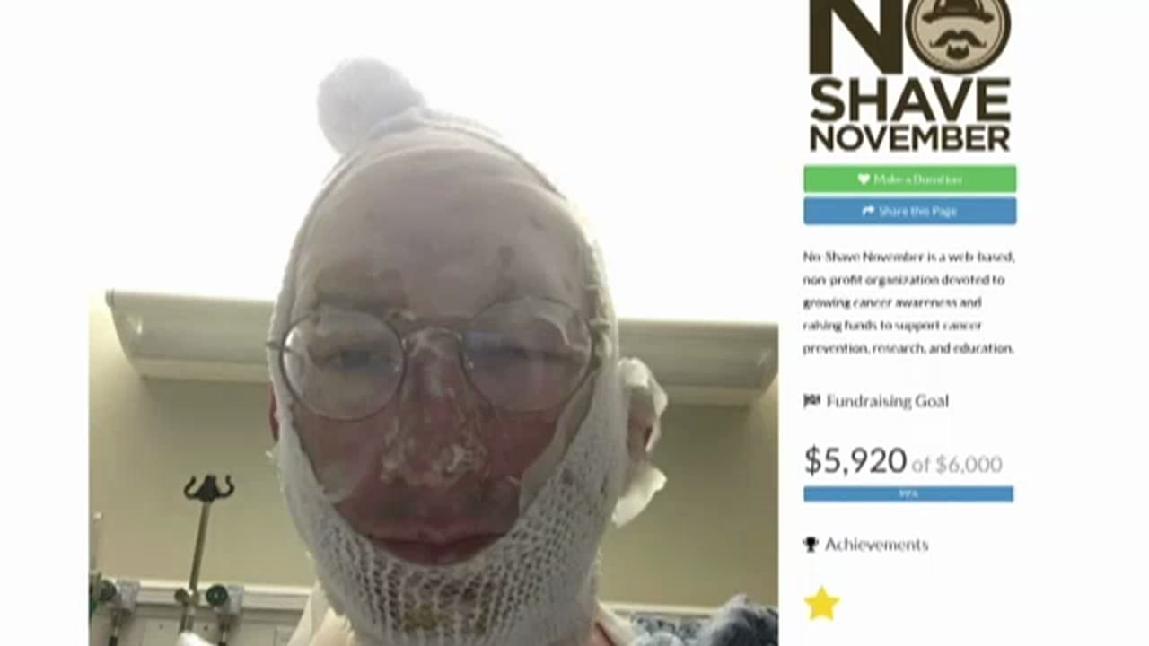 UNC professor burned in campus explosion released from hospital