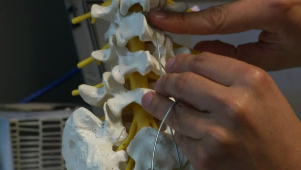 New procedure tackles chronic back pain