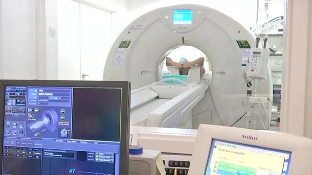 Coronary Calcium Scan Could Help Detect Potential Arterial Blockages