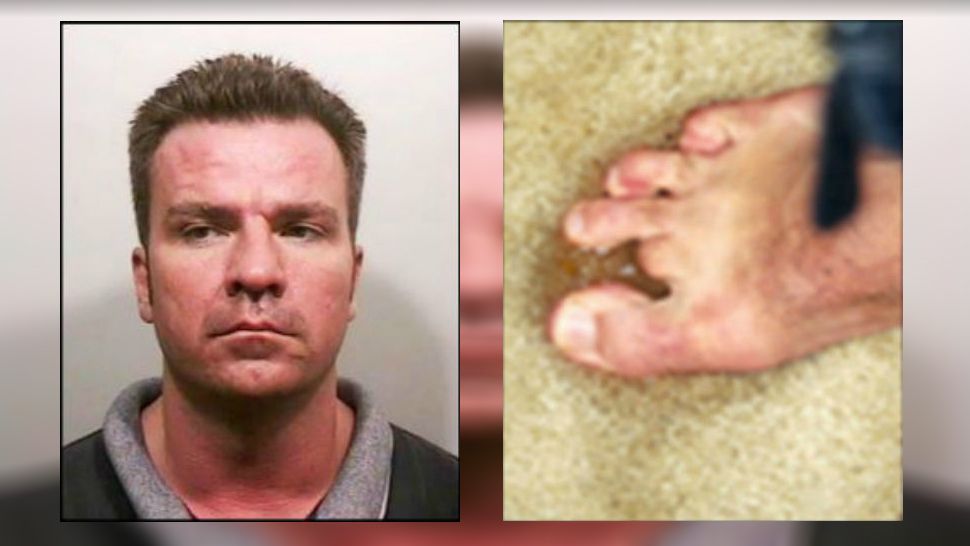 Texas fugitive's missing toe leads to his identification