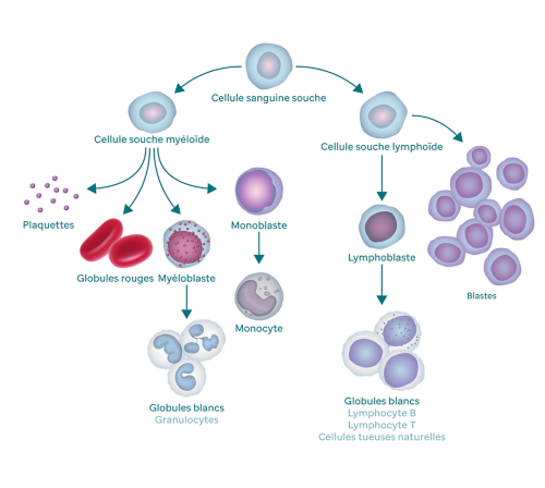 La leucémie aiguë lymphoblastique (LAL) chez l'enfant et l'adolescent ...