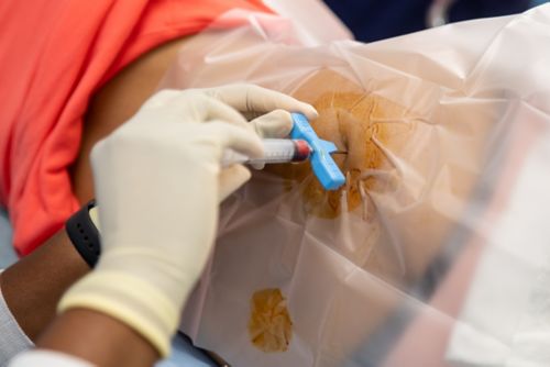 Aspiración y biopsia de médula ósea en el cáncer infantil - Juntos