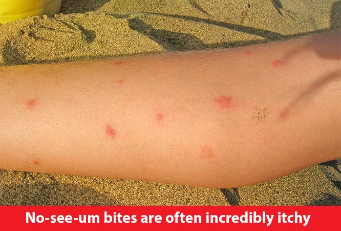 How to Get Rid of No-See-Ums